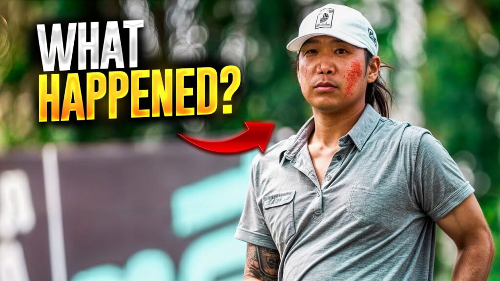 What happened to Anthony Kim's face? | Liv Golf news - FOGOLF - FOLLOW GOLF